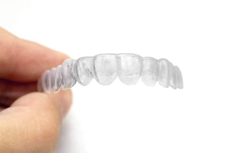 Clínica Mariana Sacoto | Fundas transparentes para dientes